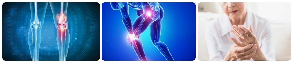 Arthritis – Kumaran Clinic
